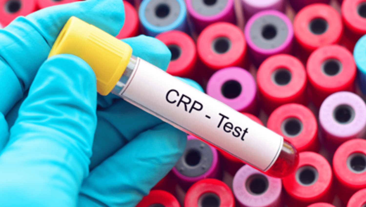 C რეაქტიული ცილა (CRP) | სინევო